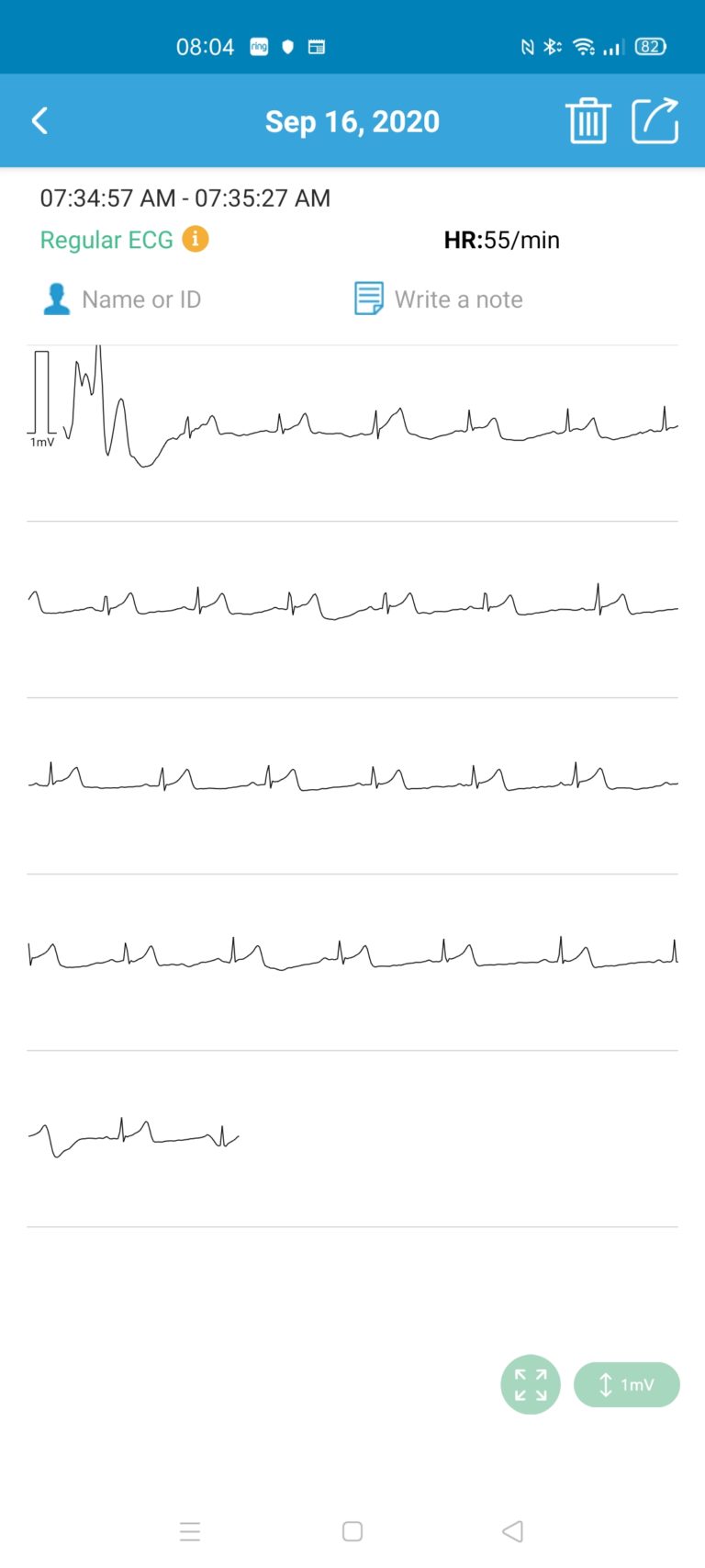 Wellue Blood Pressure Monitor and ECG Review – Better than most big ...